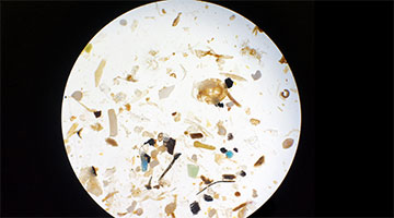 About Us - Solving Microplastics